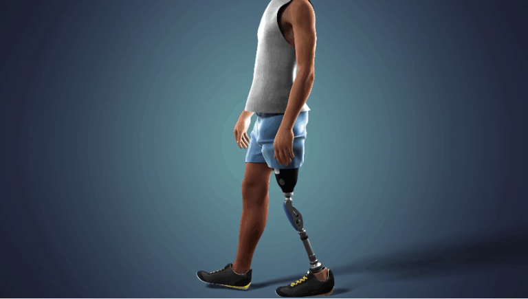 Cette prothèse de jambe permet à un amputé de retrouver des sensations